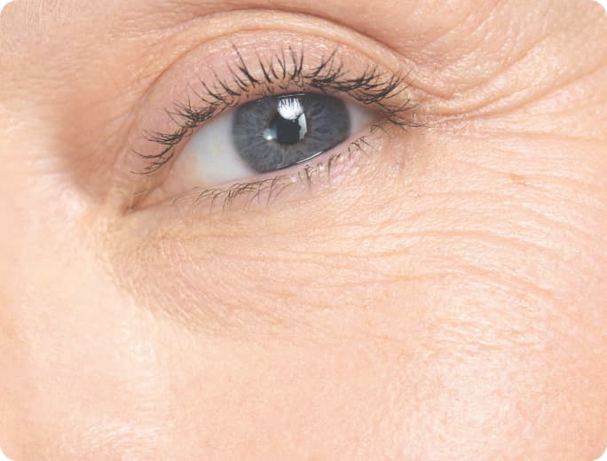 SkinConsult AI - bőrgyógyászokkal kifejlesztett algoritmus - Vichy